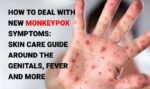 How to deal with new monkeypox symptoms: Skin care guide around the ...